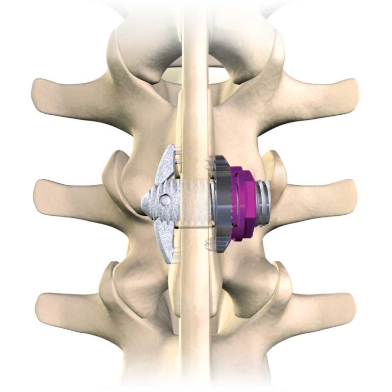 Minuteman - Acute & Chronic Pain and Spine Center - Amarillo, TX